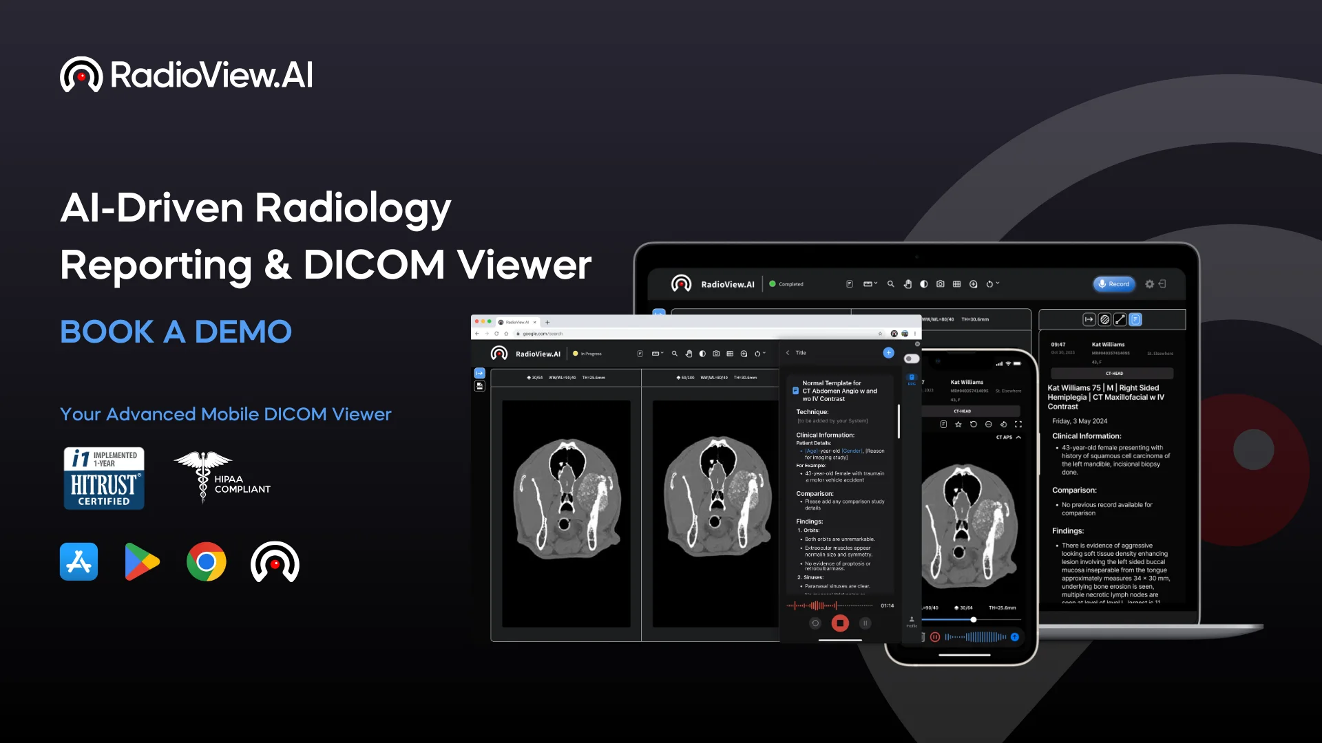 Automated Radiology Report Generation Solutions - Contact Us