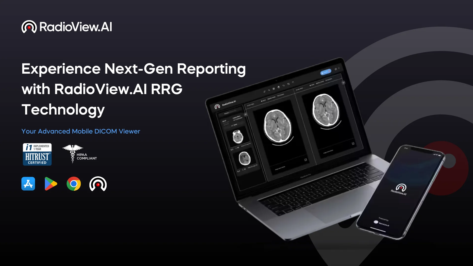 Experience Next-Gen Radiology Reporting with RadioView.AI